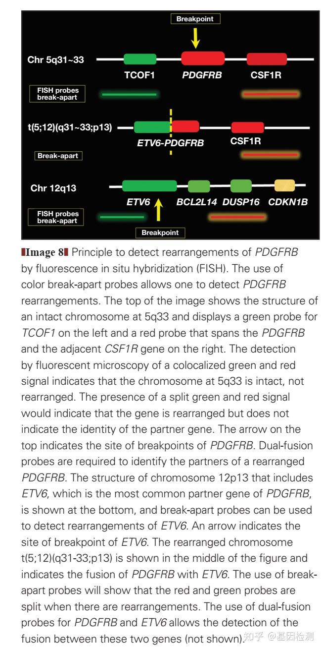 PDGFRA基因与癌症 - 知乎