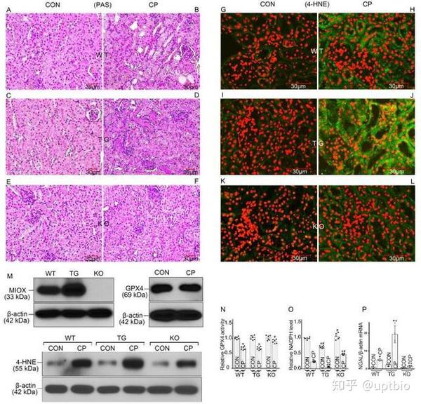 细胞病理性铁死亡？中科院一区带你探索MIOX的妙用 - 知乎