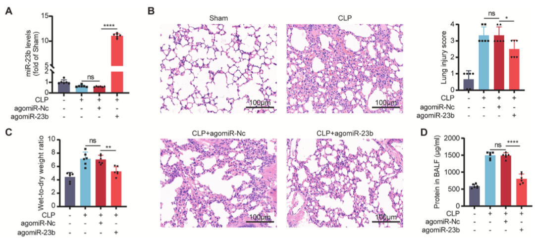 中科院一区丨甘露聚糖修饰装载了MiR-23b-3p的外泌体可以靶向治疗脓毒症肺损伤 - 知乎