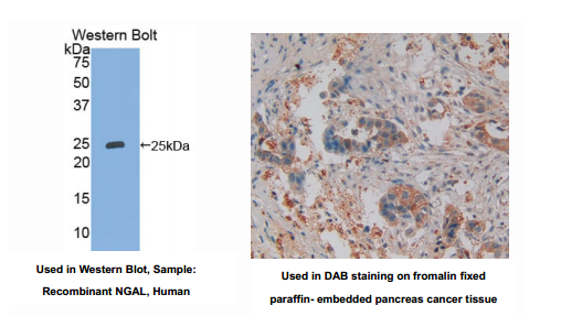 肾损伤标志物NGAL的免疫学检测 - 知乎