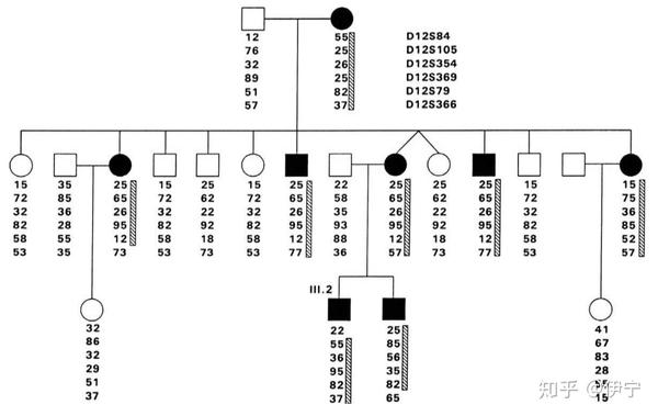 努南综合征（Noonan）的前世今生 - 知乎