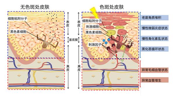 资研所Shi-Lab| 赶走色斑，只需4MSK+X？ - 知乎