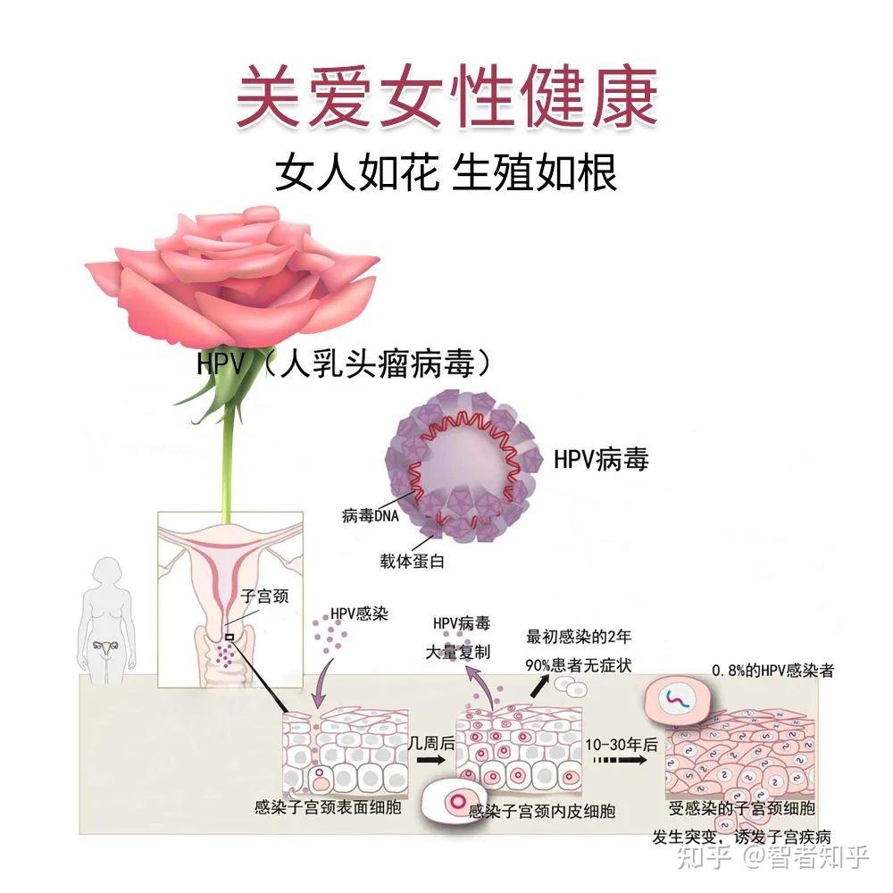 关于hpv你了解多少? 知乎