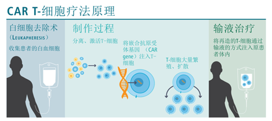 CGT创新疗法——慢病毒包装CAR-T免疫细胞 - 知乎