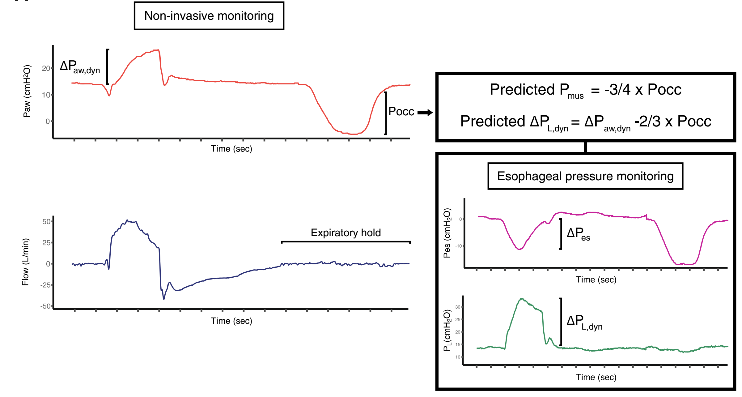 呼气末阻断操作监测患者-呼吸机交互 - 知乎