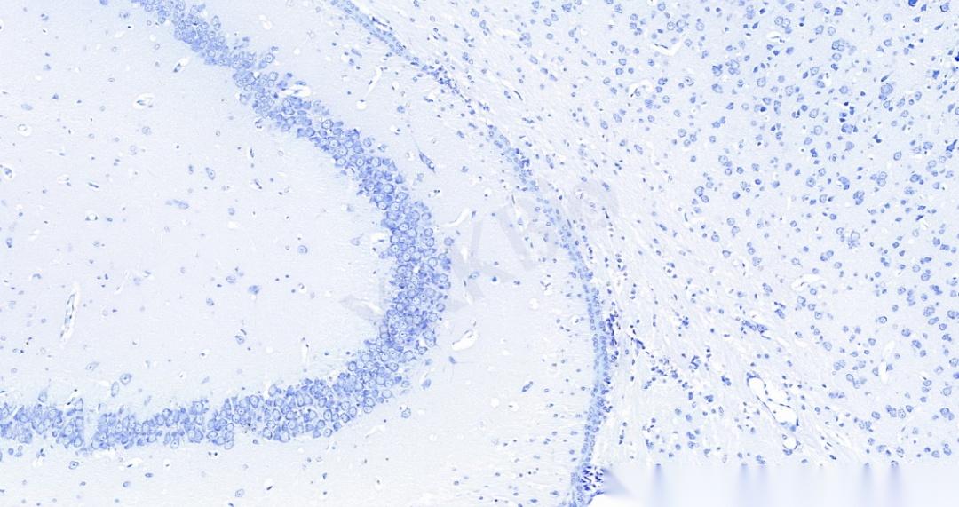 脑组织实验前处理方法及常做的染色 - 知乎