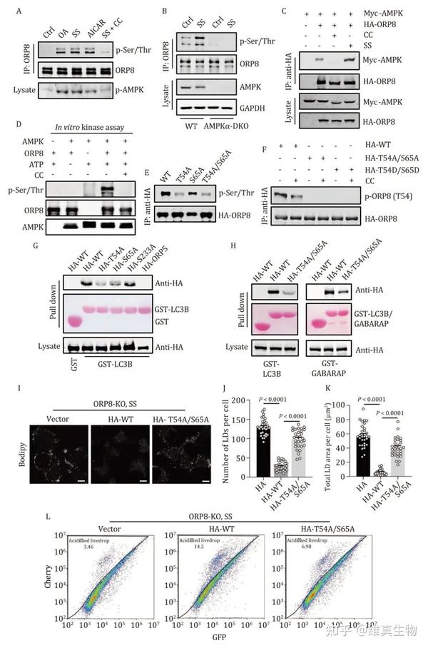 IF=15.328：浙大医学院刘伟/Dante Neculai团队合作揭示脂质转移蛋白ORP8在脂滴自噬中的关键作用 - 知乎