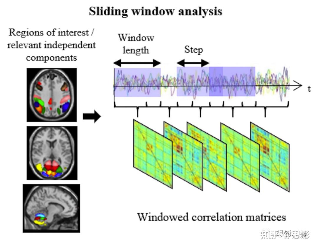 静息态fMRI的当前方法和新方向 - 知乎