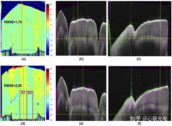 在3D-OCT图像中使用半自动配准和分割对牙龈组织体积进行测量 - 知乎