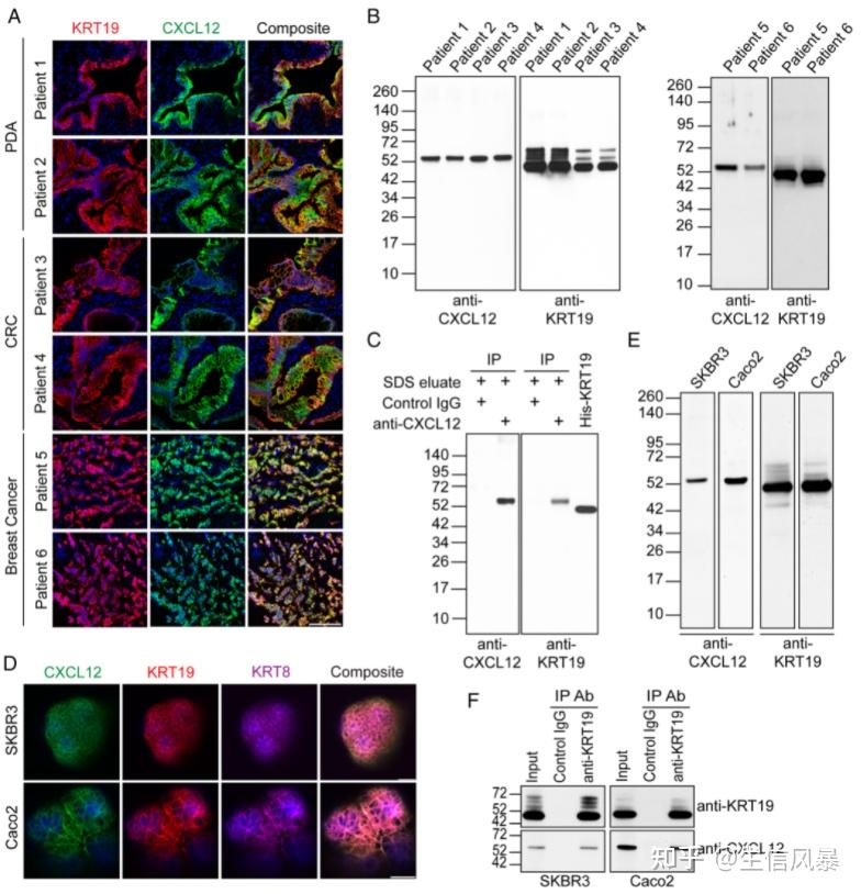 PNAS:癌细胞用CXCL12-KRT19涂层可以逃避癌症免疫攻击。 - 知乎