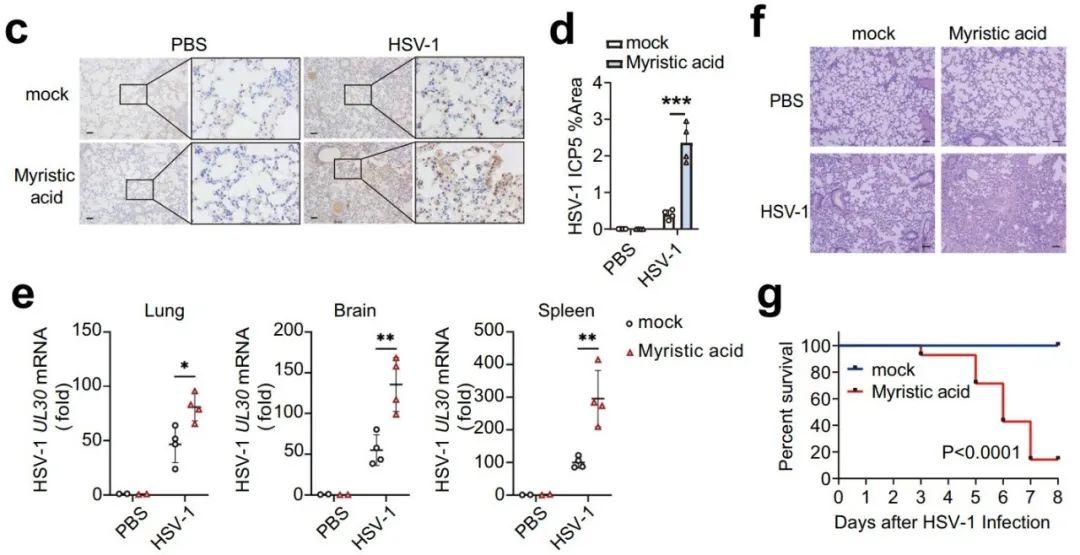Nat Commun︱山东大学赵伟团队揭示代谢调控抗病毒固有免疫新机制 - 知乎