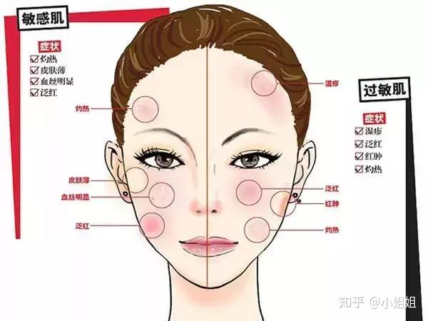 教你轻松判断皮肤问题,度过皮肤 敏感”期 知乎
