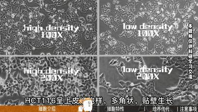 HCT116细胞培养，人结肠癌细胞培养攻略-丰晖生物 - 知乎