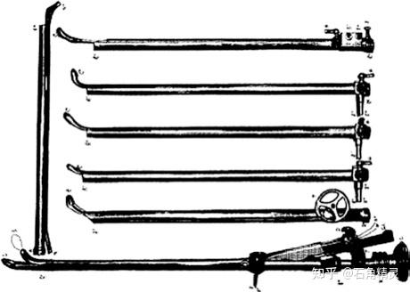 泌尿传奇：经尿道膀胱肿瘤电切和电灼的历史 - 知乎