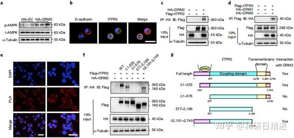 Nature metabolism丨肝脏因子ORM2通过抑制脂肪从头生成维持肝脏脂质稳态 - 知乎