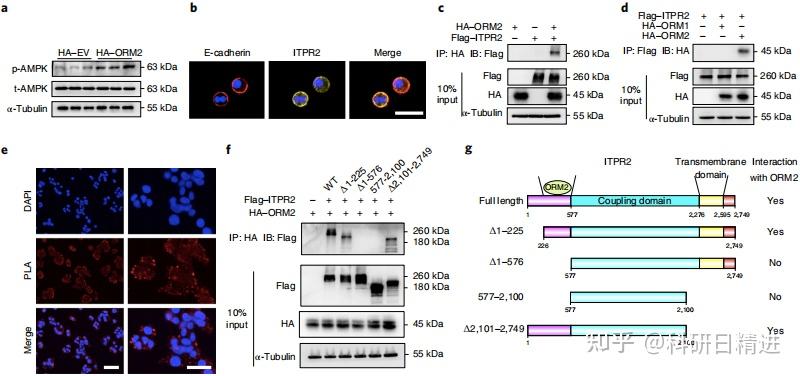 Nature metabolism丨肝脏因子ORM2通过抑制脂肪从头生成维持肝脏脂质稳态 - 知乎