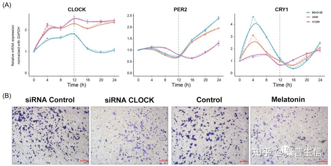 13+昼夜节律相关的单细胞预后思路分享 - 知乎