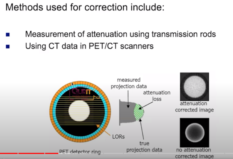 医学图像重建个人笔记 - 知乎
