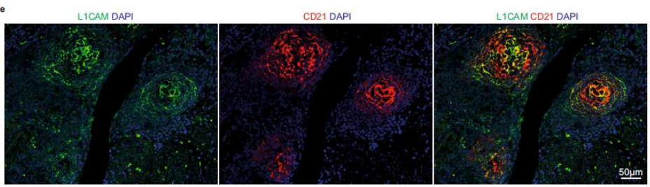 三级淋巴结构在肿瘤微环境中的作用 - 知乎