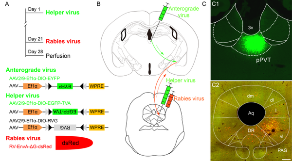 【客户文章】空军军医大学李云庆教授、董玉琳副教授团队在pPVT-CeA-vlPAG下行通路参与疼痛易化研究中取得新进展 - 知乎