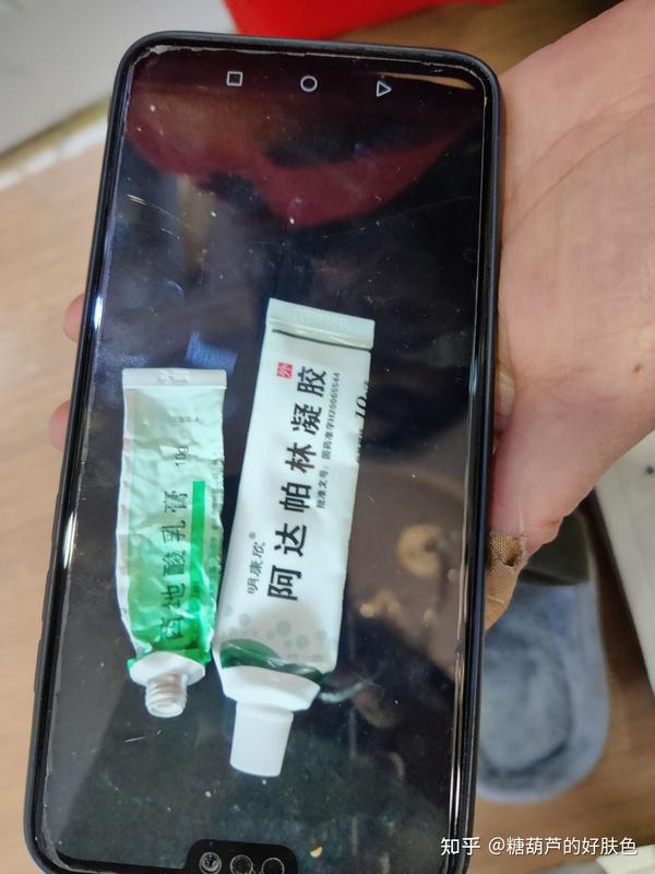 战痘好物分享 知乎