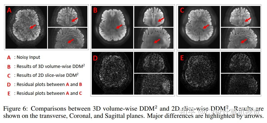 ICLR 2023 | 斯坦福提出DDM2：基于生成扩散模型的自监督扩散MRI去噪 - 知乎
