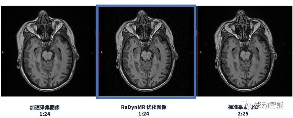影动医疗『招商中』 | 打造降本增效的AI医学影像，提升诊疗服务三大痛点 - 知乎