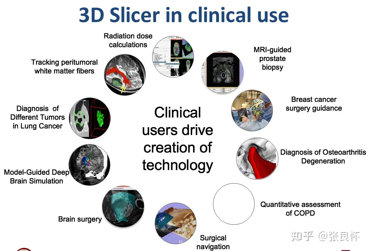 开源医学影像分析平台--3D Slicer - 知乎