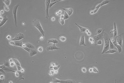 HepG2、SK-Hep-1:苏州鉴达细胞鉴定(Cell Line Authentication)预警系列14 - 知乎