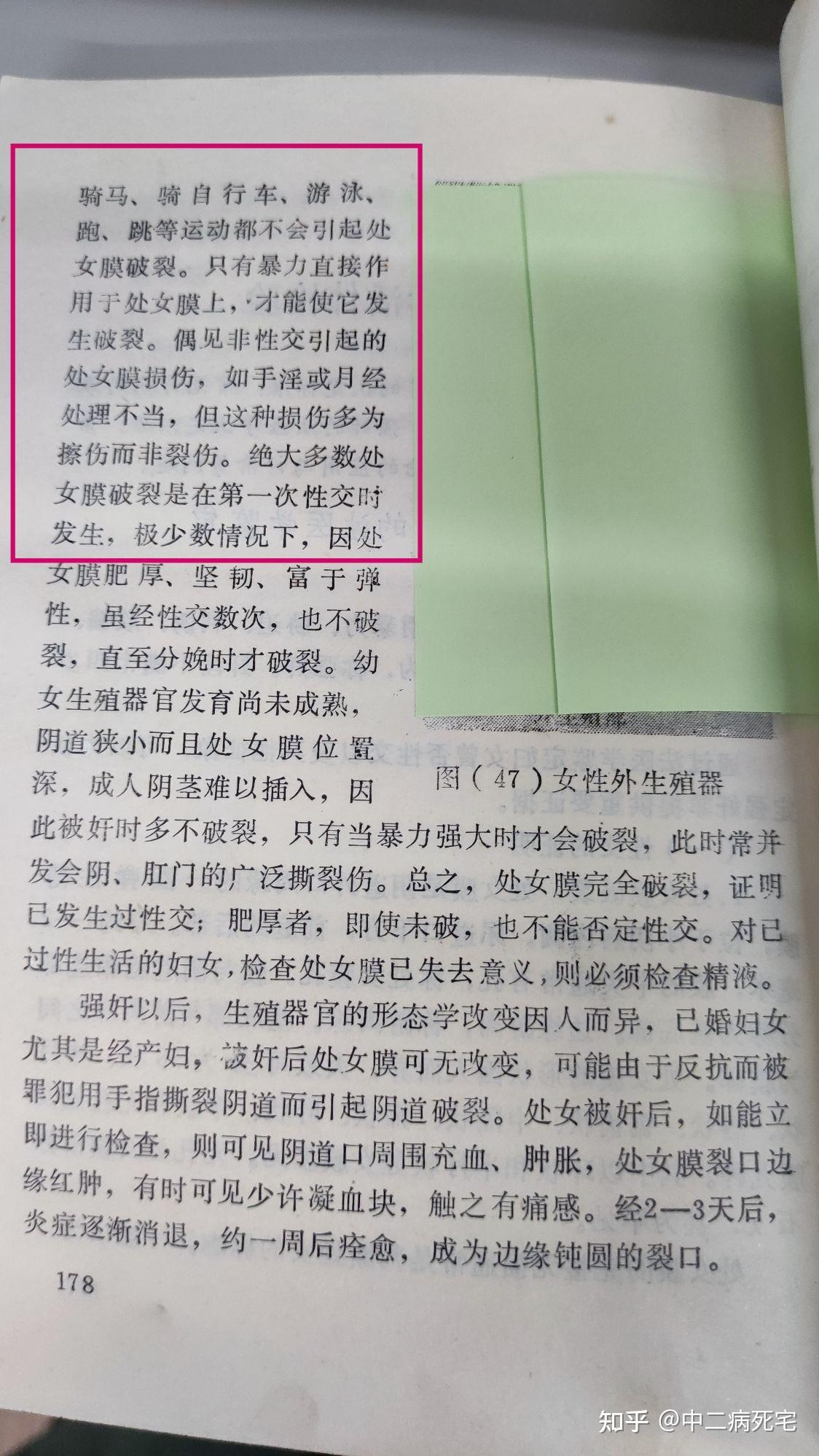 法医学破除运动会导致处女膜破裂的谣言 知乎