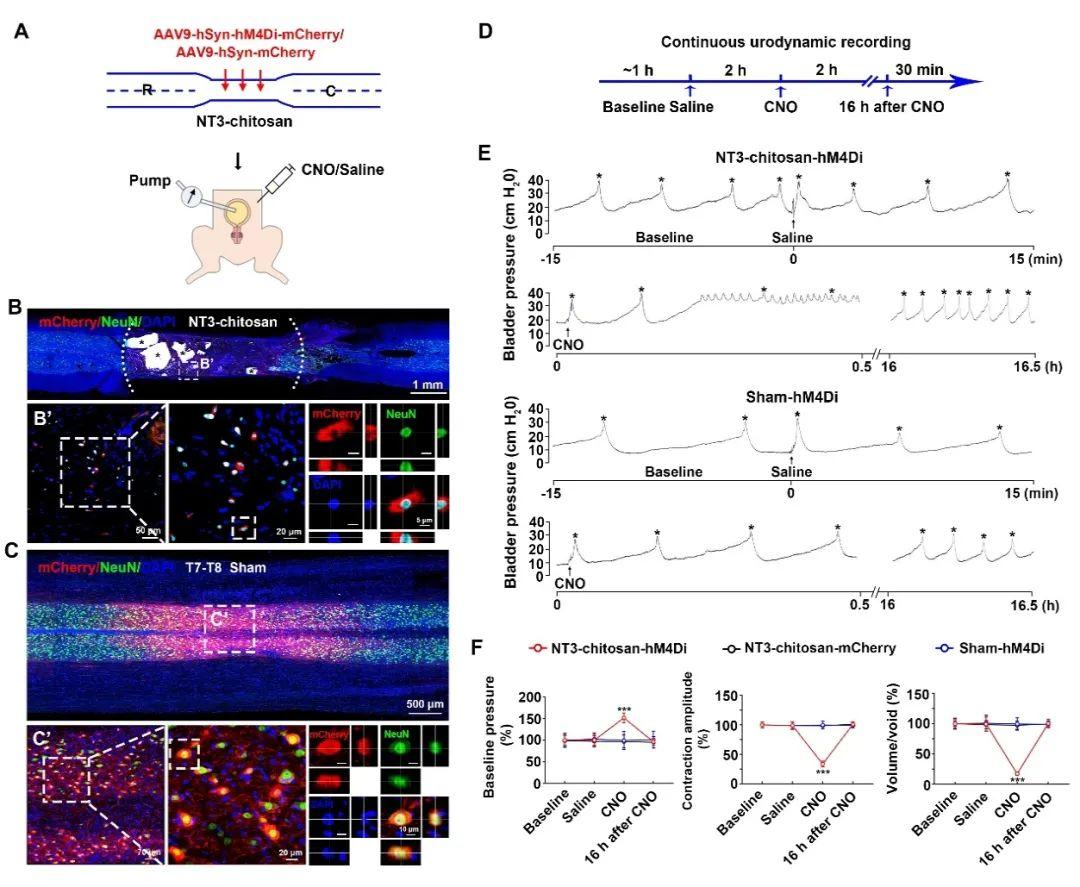 IF=15.304【客户文章】北航李晓光教授团队发文阐明脊髓损伤修复后新生神经元的正确连接控制膀胱功能的新进展 - 知乎