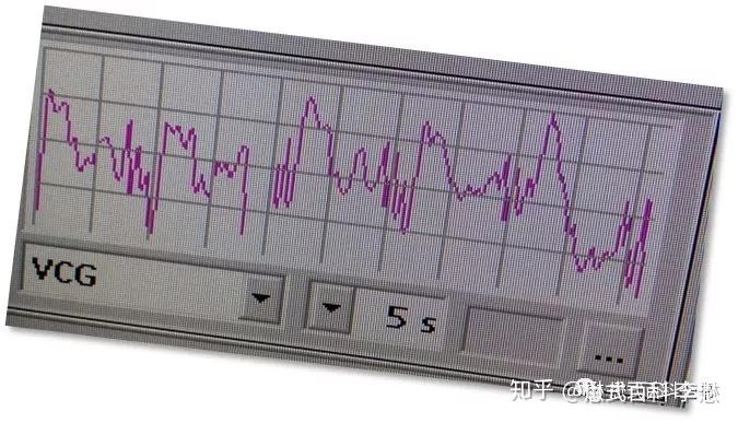心脏磁共振技术大全（一） - 知乎