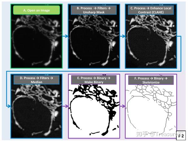 ImageJ实用技巧——线粒体网络形态分析(插件篇) - 知乎