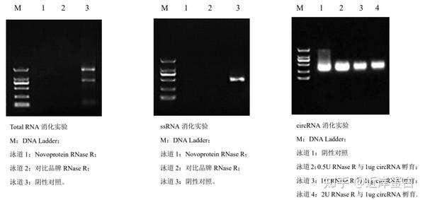 GMP级RNase R重磅上线，环状RNA那么火，你开始研究了吗？ - 知乎