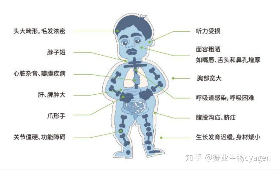 可治！期待粘宝宝们“破茧重生”#罕见病科普# - 知乎