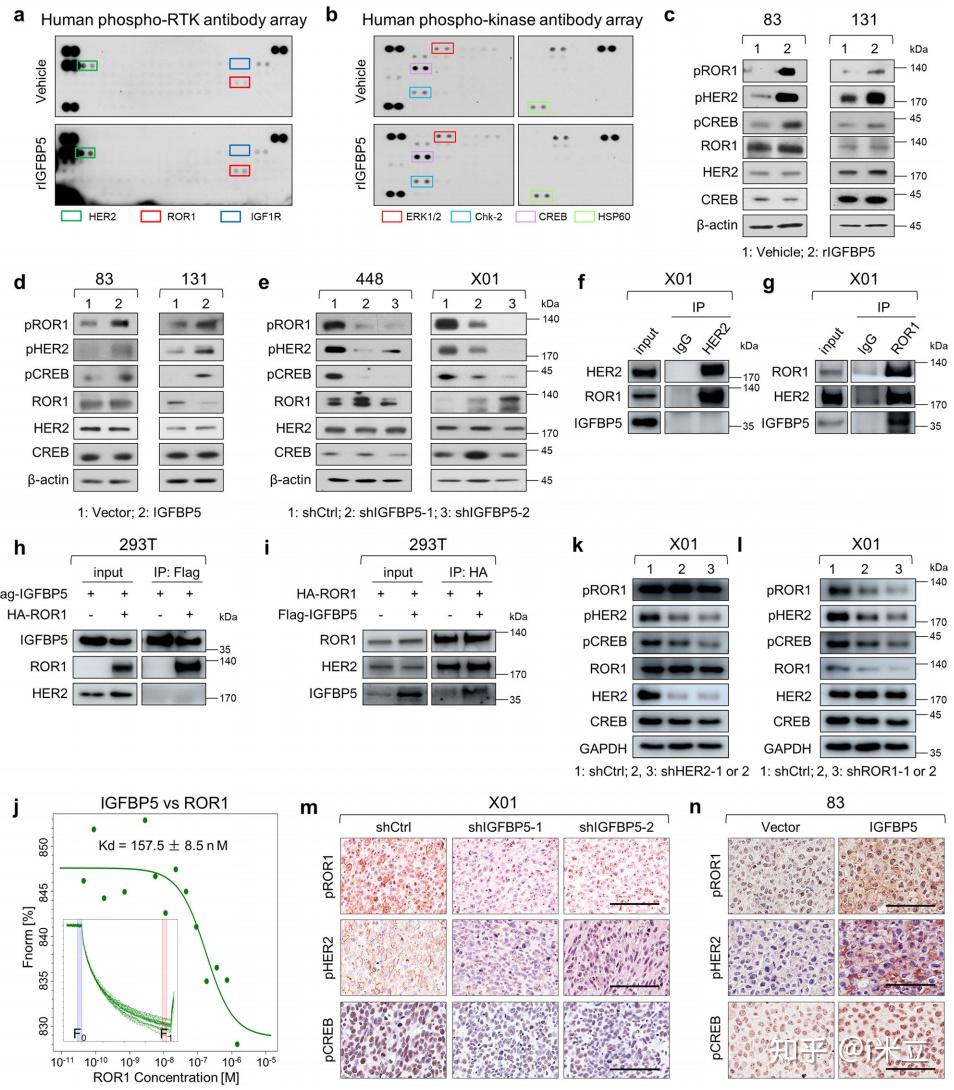 IF:16.6|改善侵袭性GBM患者预后的新策略-靶向抑制GBM干细胞样细胞（GSC）关键靶点：IGFBP5 - 知乎