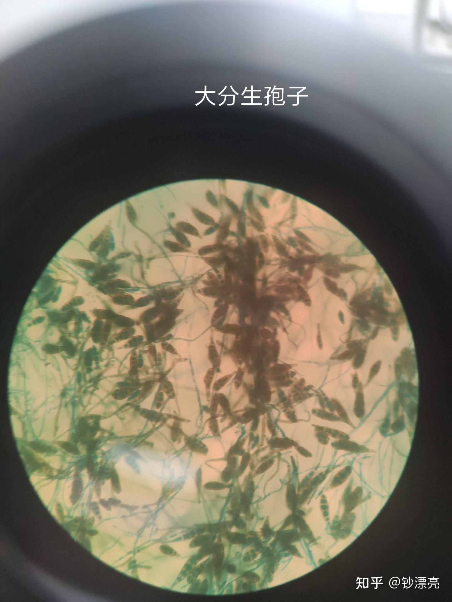 微生物显微镜🔬下观察 - 知乎