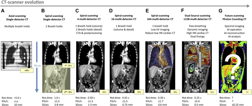 收藏！全球CT技术变迁史 - 知乎