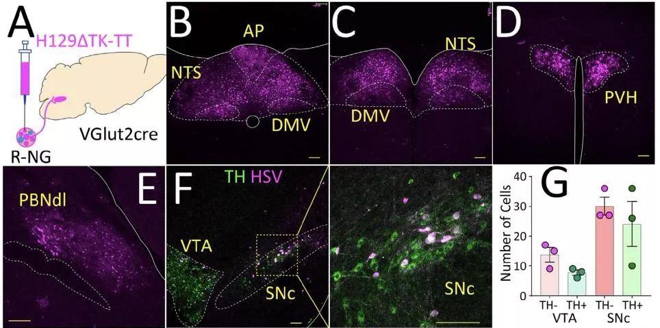 【文献解读】Cell丨脑肠轴如何调控奖赏系统？ - 知乎