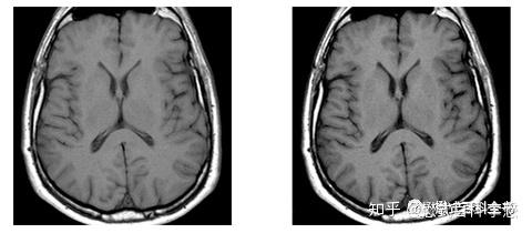 射频脉冲翻转角之Ernst Angle - 知乎