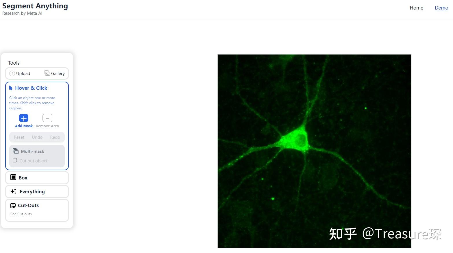 利用Segment Anything进行细胞分割 - 知乎
