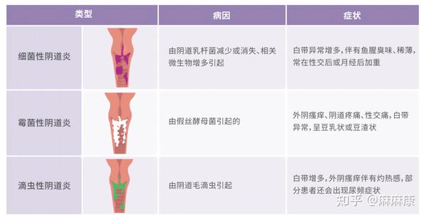为什么女性容易得阴道炎、宫颈炎、盆腔炎?妇科炎症该怎么预防? 知乎