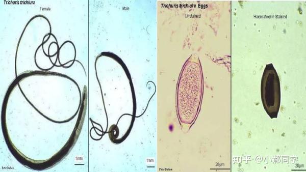 卫生资格考试检验专业(寄生虫学检验部分)消化道寄生虫章节考点都有哪些？ - 知乎