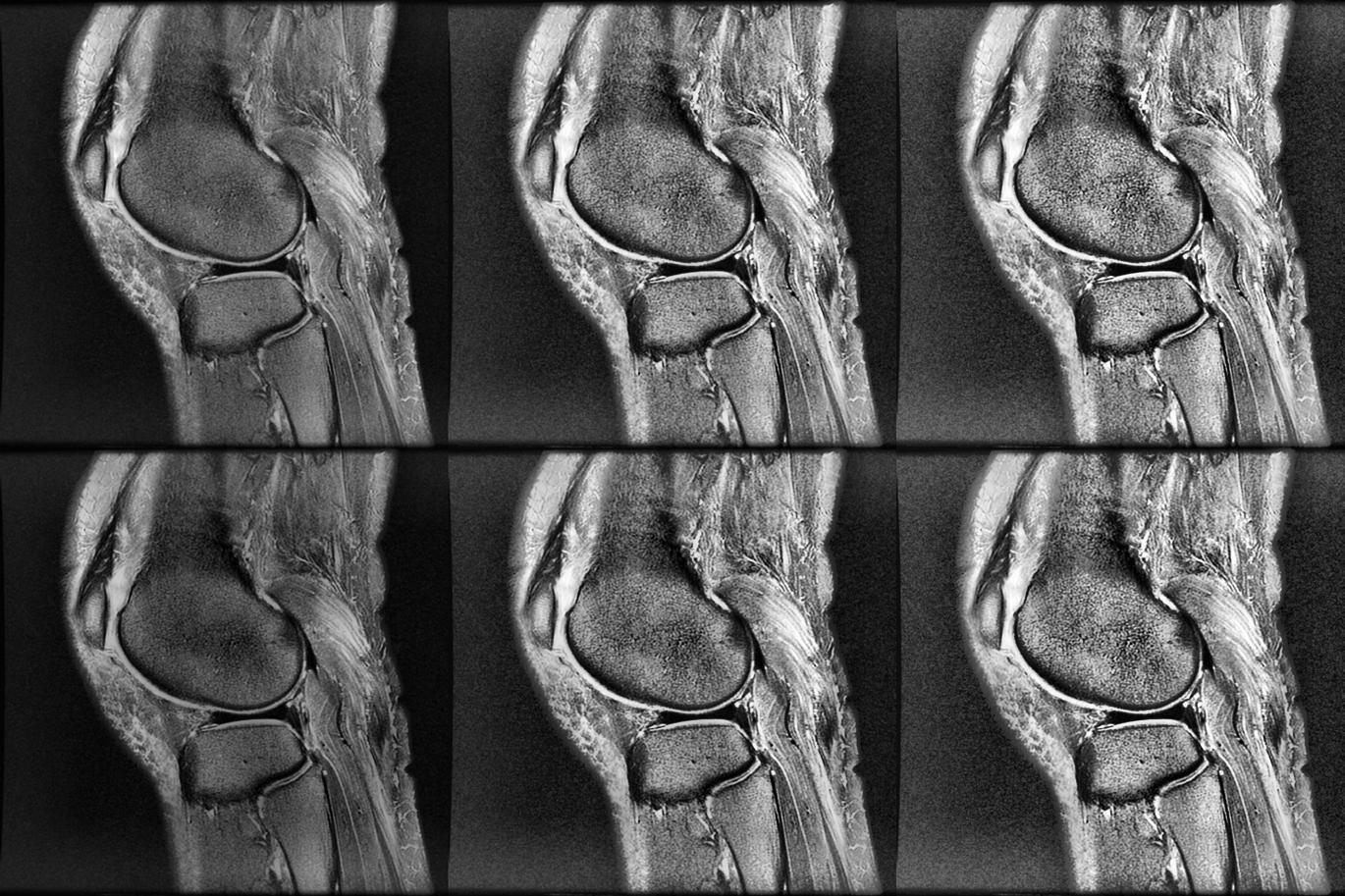 关于 CLAHE 的理解及实现 - 知乎
