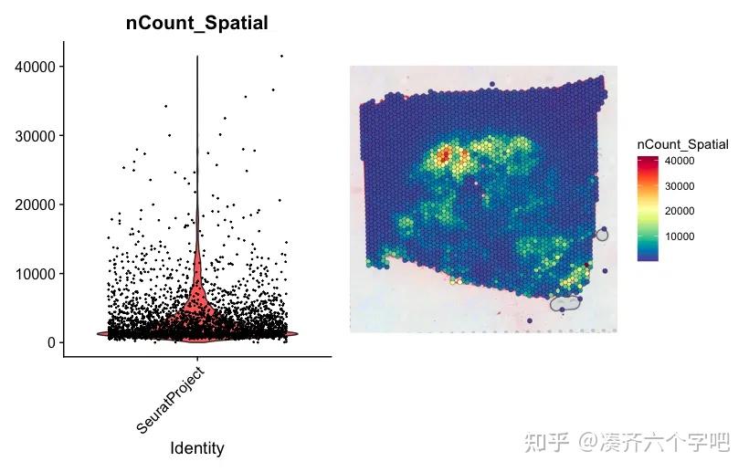 单细胞空间转录组分析流程学习(二) - 知乎