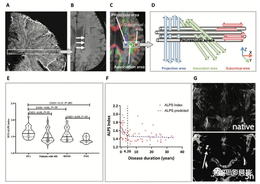 Radiology：磁共振成像在多发性硬化症中的应用 - 知乎