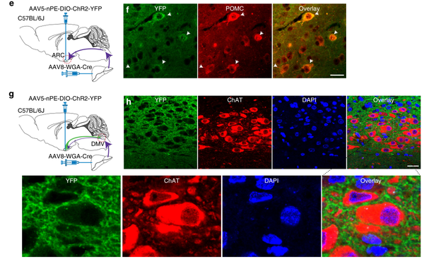 【文献解读】血糖高低谁主导？下丘脑弓状核POMC神经元调节血糖稳态的神经生物学机制 - 知乎