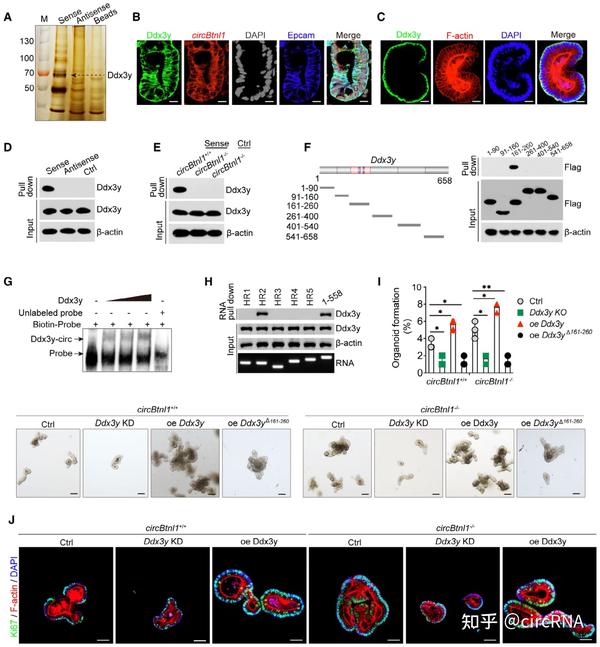 EMBO J | 新发现！circRNA可以调控肠道干细胞的自我更新 - 知乎