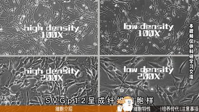 SVGp12细胞培养，人星形胶质细胞培养攻略 - 丰晖生物 - 知乎