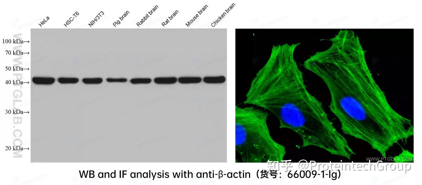 WB指南 | 18种常用WB内参大盘点！码住！ - 知乎